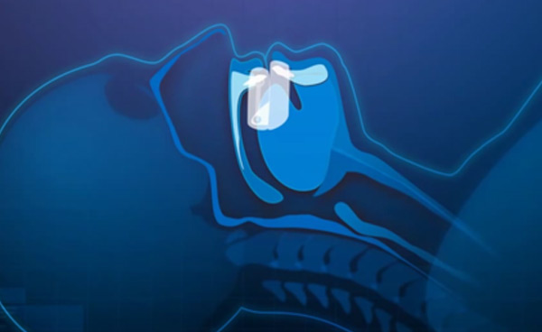 Le ronflement, vous... et les autres