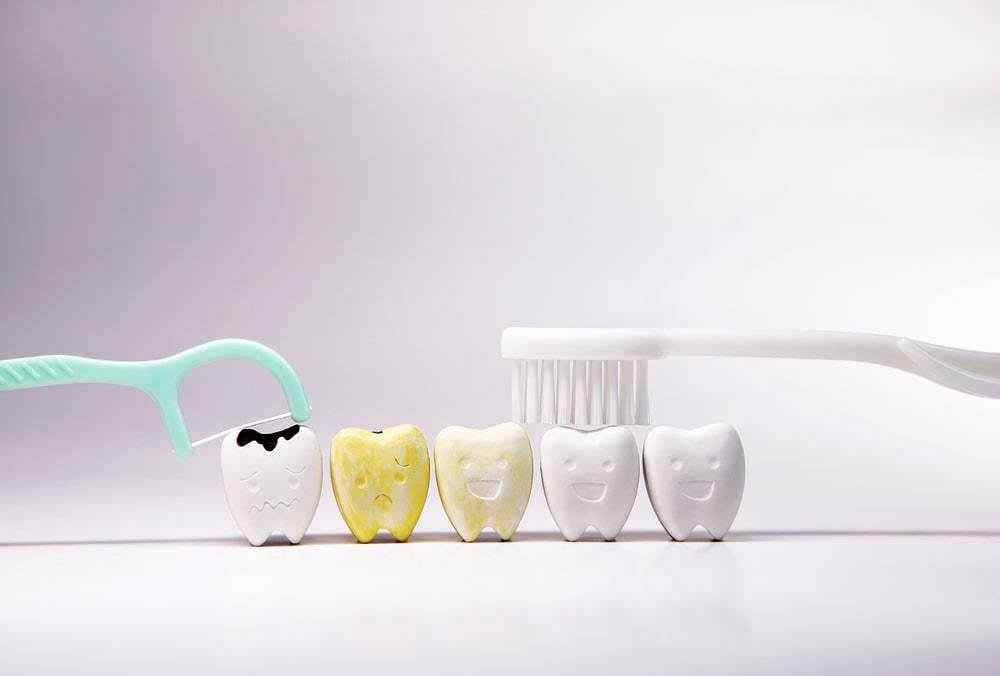 Pourquoi ai-je les dents jaunes